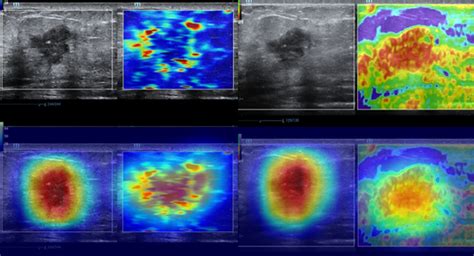 Xin Yang Shenzhen University