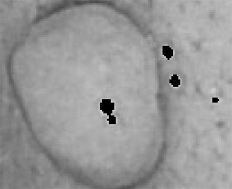 matlab remove the holes in an image by average values of surrounding