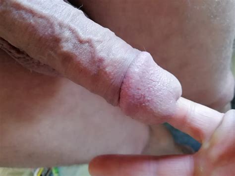 Dialator 28 Pics XHamster