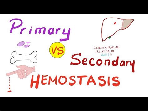 Free Video Primary Vs Secondary Hemostasis From Medicosis