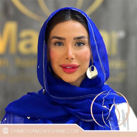 Removing Bruises After Gel Injection A Guide To Quick Recovery Dr