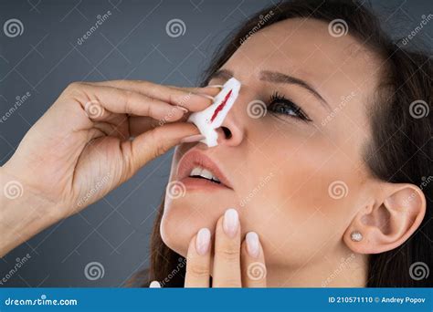 Woman Trying To Stop Nose From Bleeding Stock Photo Image Of Bleeding Handkerchief
