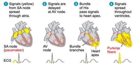 Ecg Flashcards Quizlet