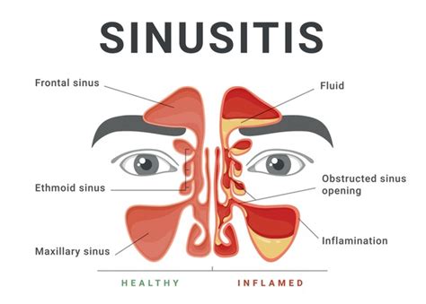 2 Thousand Anatomy Of The Nose And Nasal Cavity Royalty Free Images