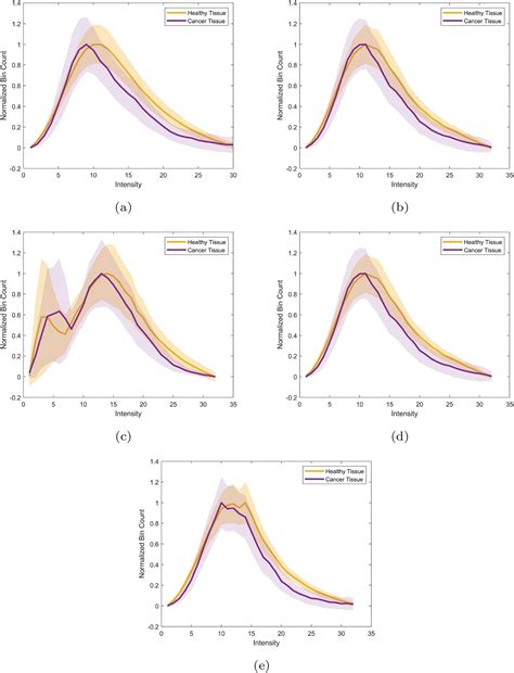 Effects Of Mri Image Normalization Techniques In Prostate Cancer