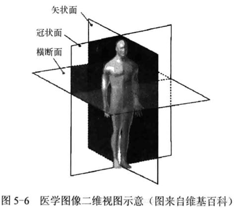 Vtk系列20显示三维医学图像mhd的某个切面使用vtk显示三维切面 Csdn博客