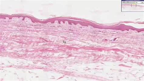 Histology Of Thin Skin
