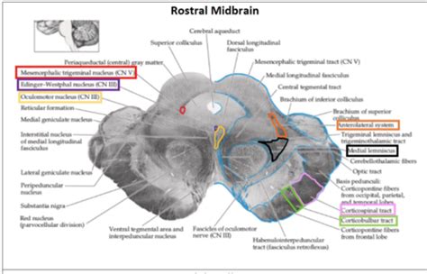 Neuro Exam 2 Flashcards Quizlet