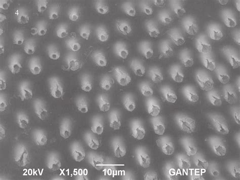 Sem Image Of The Dentin Surface After Application Of The Eryag Laser Download Scientific
