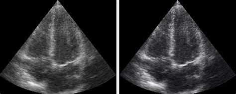 Using Fast On Ultrasound Data In Python Fast Documentation