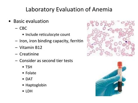 Lab Exam For Anemia At Lonnie Allen Blog