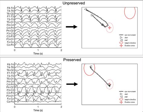 Table 1 From Neurophysiological Signatures Reflect Differences In