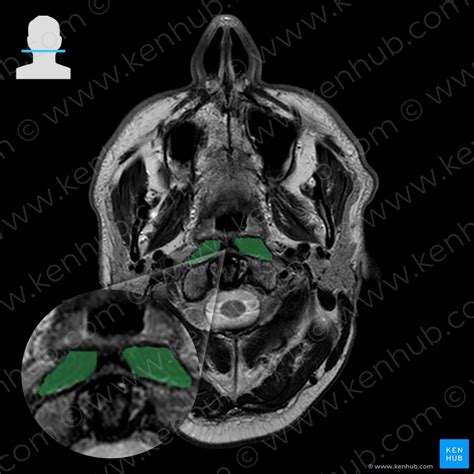 Longus Capitis Origin Insertion Innervation Action Kenhub