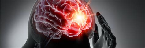 Tenecteplase Safety Similar To Tpa For Acute Ischemic Stroke