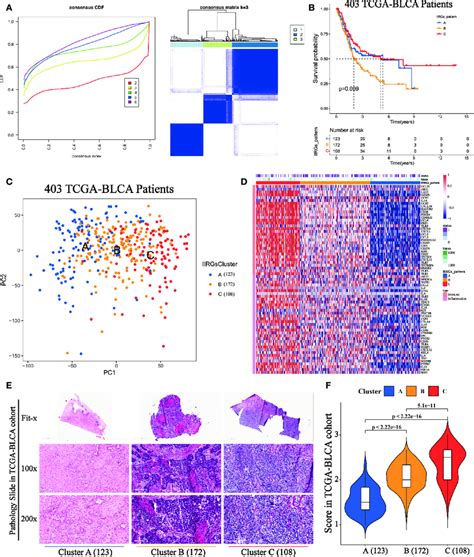 Unsupervised Consensus Cluster Analysis Of Iirgs In Tcga Blca Cohort