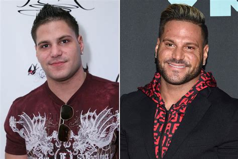 Pauly D Plastic Surgery