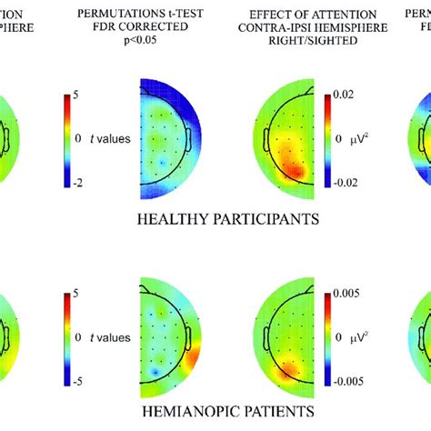 Hemispheric Differences Of The Attentional Effect Permutation T Test