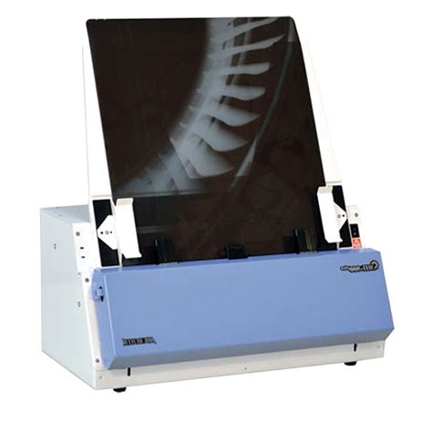 Durable Mammography X Ray Film Scanner Sale Or Rent Near Me Goldstar