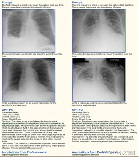 Gpt 4v：ai在医疗领域的应用