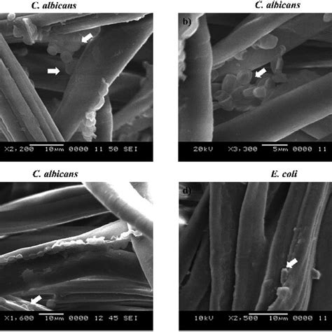 Types Of Threads And Their Respective Sem Images A Twisted Download Scientific Diagram