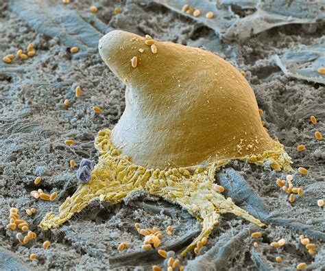Amoeba Fruiting Body Sem Stock Image C0562240 Science Photo Library