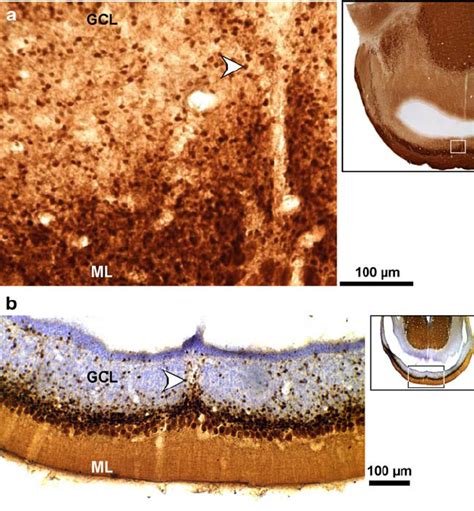 Presence Of Very Small Calbindin Immunoreactive Cells In Granule Cell Download Scientific