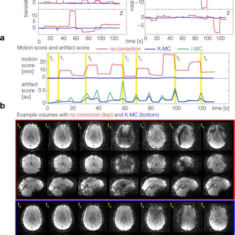 Diagram Of The 3d Hybrid Radial Cartesian Sampling Scheme Top
