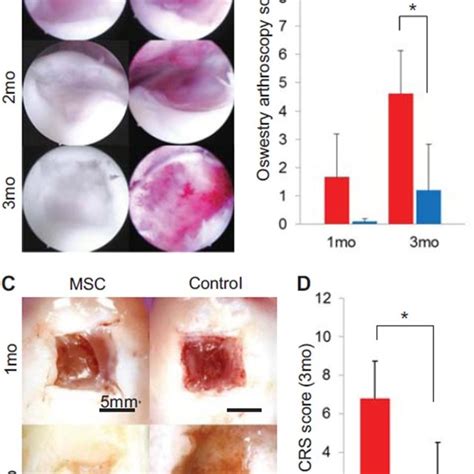 Histological Analyses Of Cartilage Defect Transplanted With Mscs