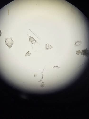Lab Unit 1 Protists Pictures Flashcards Quizlet