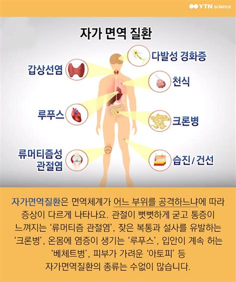 내 몸이 나를 공격한다 ‘자가면역질환 — Synthesis Based Biofusion Technology Lab