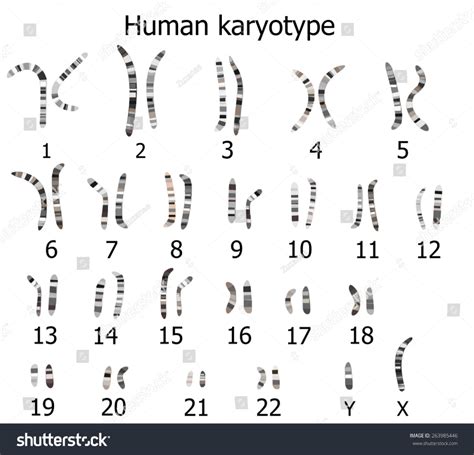 Human Karyotype Illustration Stock Illustration 263985446 Treino