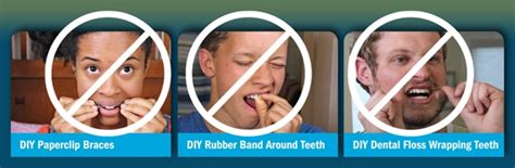 DIY Orthodontics Dennis J Flanagan DDS MS Rockford Winnebago IL