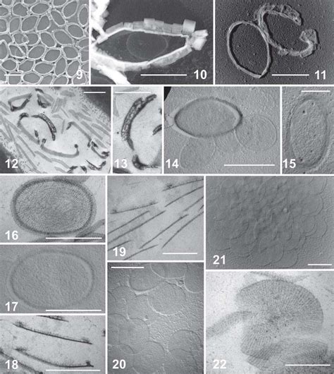 Electron Micrographs Of Coccoliths And Scales 9 15 Diploid Calcifying