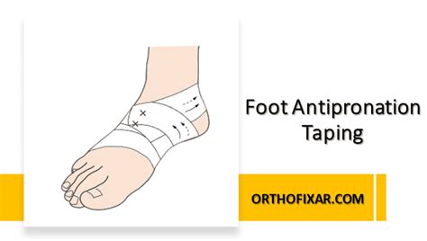Hardinge Approach Orthofixar 2025