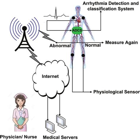 The Overall Architecture Of Arrhythmia Detection System Download