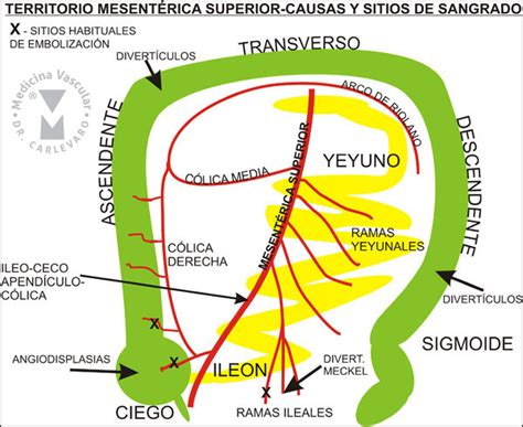 El Nivel De La Arteria Mesentérica Inferior