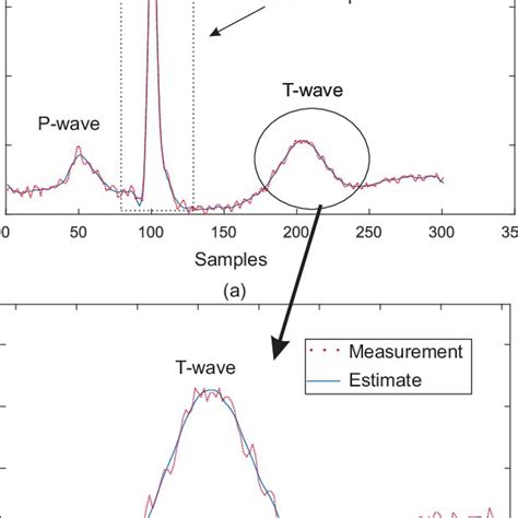 An Ecg Signal And A T Wave A Ecg Signal Estimate Solid And Noisy