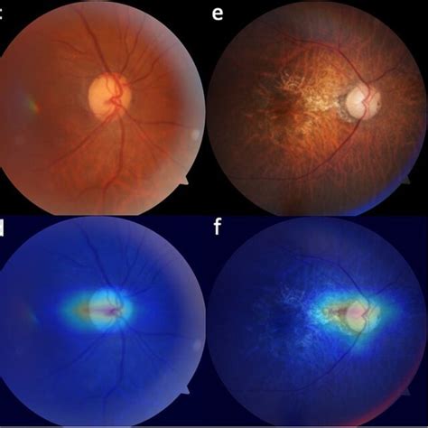 Binary Classification Presented By Heatmap To Show Weighted Area Of Download Scientific Diagram