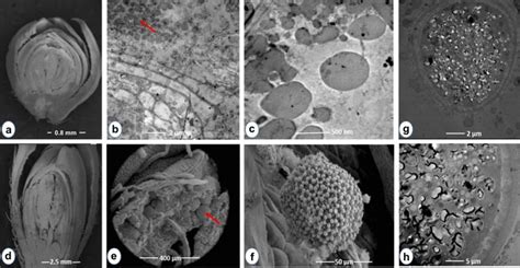 Microscopic Microspores