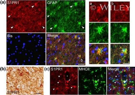 Mhc Class Ii I Ai E Antibody 14 5321 82