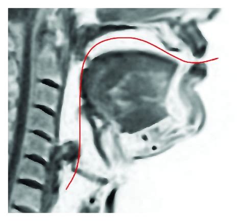 Vocal Tract Geometry Modeling Results A Centerline Position Within A Download Scientific