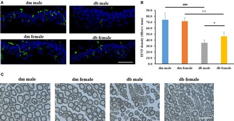 Influence Of Sex On Cognition And Peripheral Neurovascular Function In Diabetic Mice Pmc