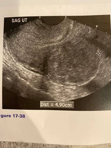 Section 17 Questions Flashcards Quizlet