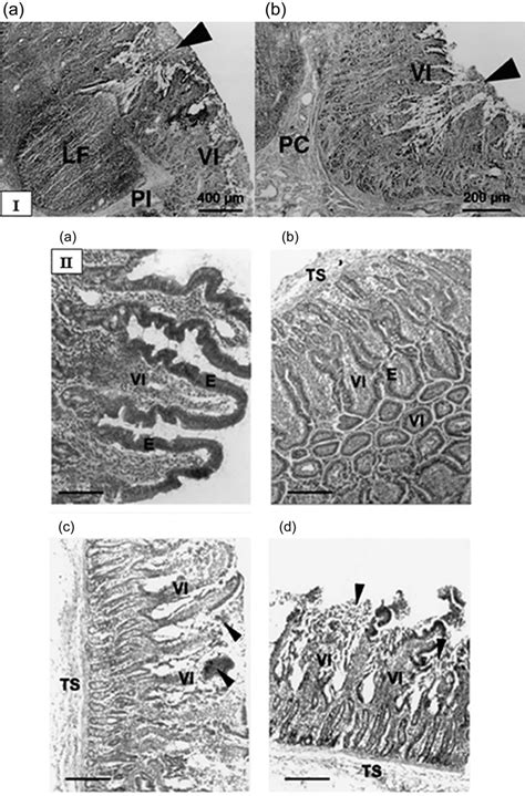 23 I Microscopic Image Of Peyers Patch A And Non Peyers Patch B