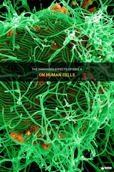 The Damaging Effects Of Ebola On Human Cells Medshun