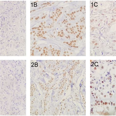 A Sex Vs Disease Free Survival B Puberty Completed At Diagnosis Vs Download Scientific