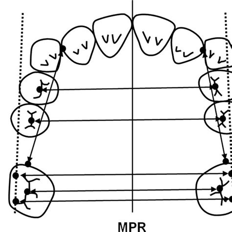 skeletal angular and linear measurements cephalometric analysis tab