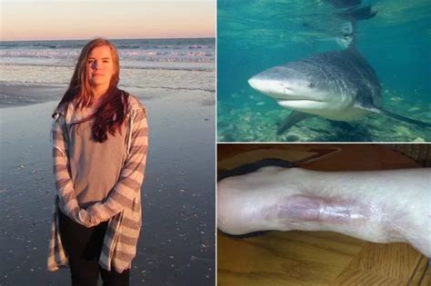 Bull Shark Bite