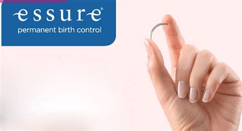 Essure Birth Control
