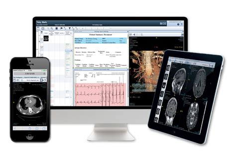 Ge Centricity™ Universal Viewer Zero Footprint Syaf Unica Indonesia